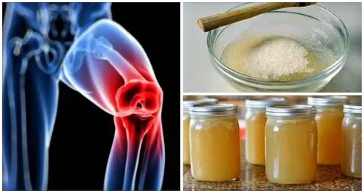 Află cum poți să scapi de durerile articulare cu gelatină - DeRetinut
